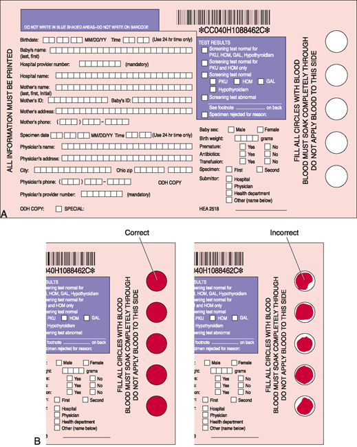 Capillary Puncture – Learn HCIS – LVN and MA Certification