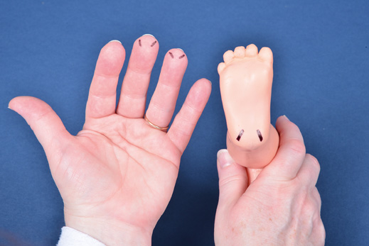 Capillary Puncture – Learn HCIS – LVN and MA Certification