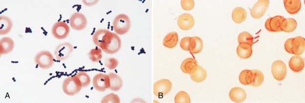 Characteristics of Bacteria – Learn HCIS – LVN and MA Certification